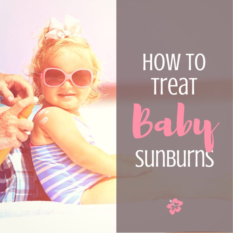 How to Treat Sunburns